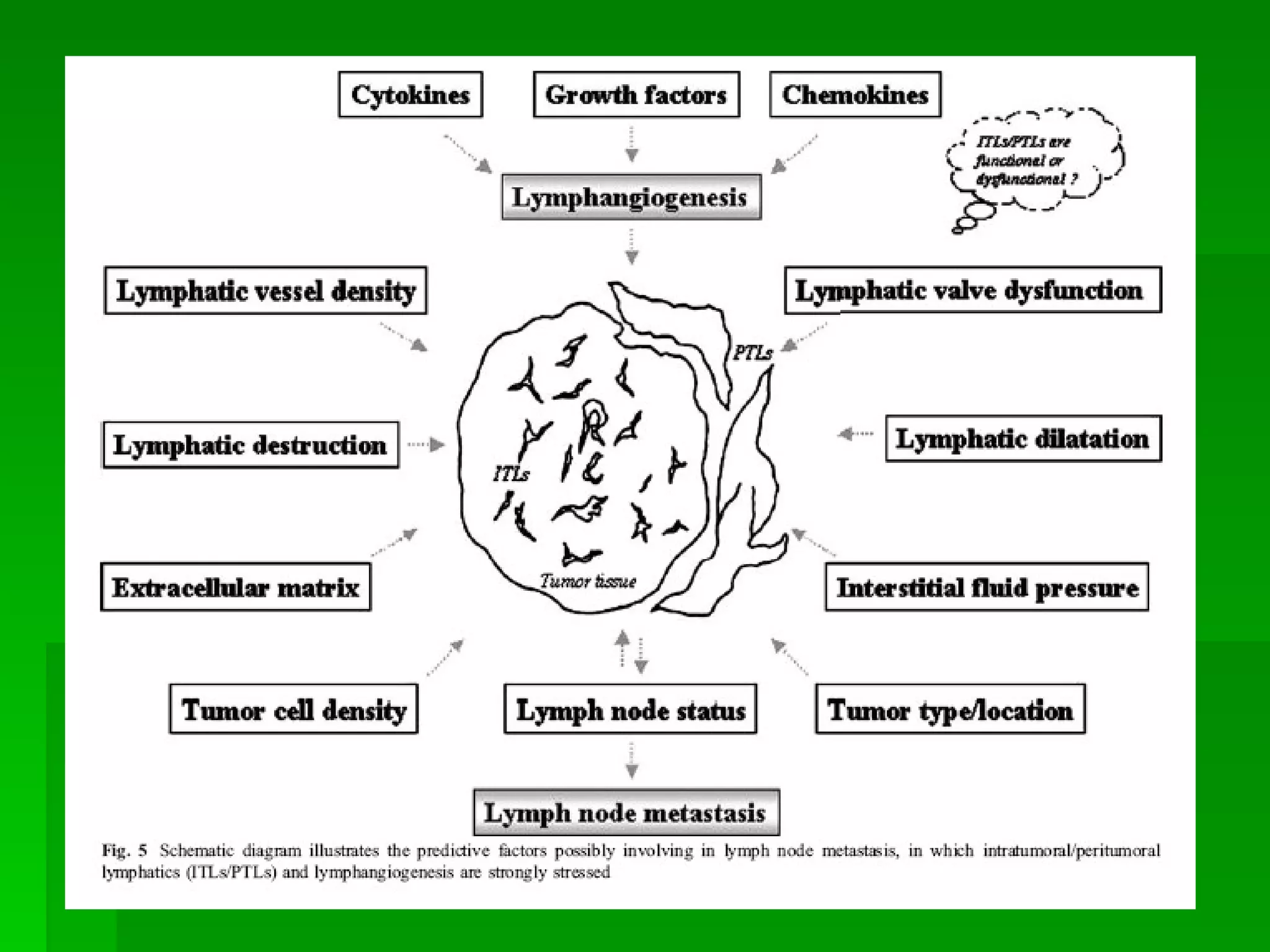 8. Cancer Metastasis Lymphatic Spread | PPT