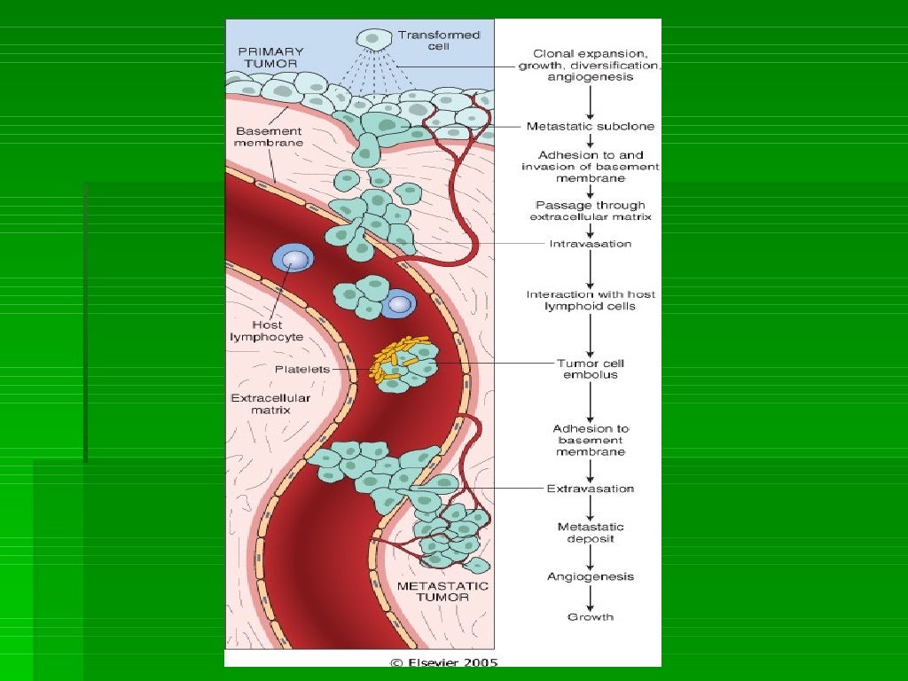 8 Cancer Metastasis Lymphatic Spread