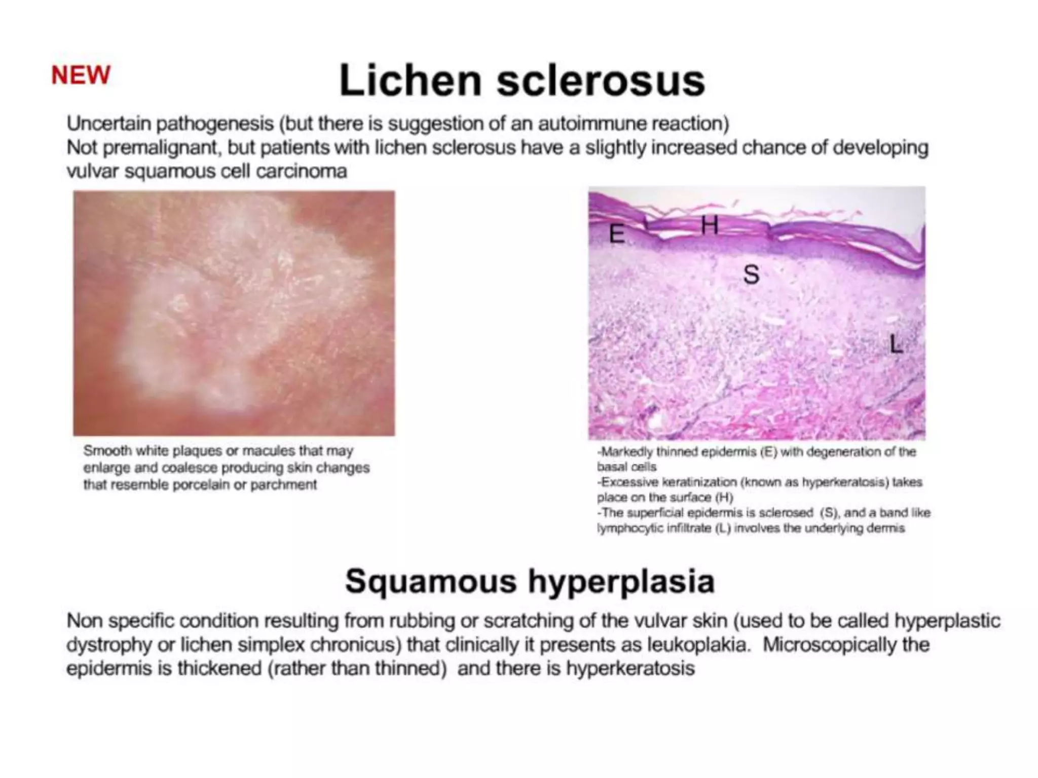 8 Lesions of vulva and vagina 19-3-2018 | PPT