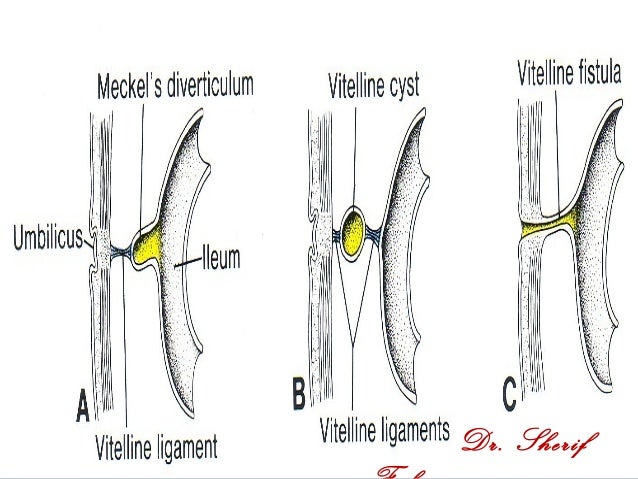 Development of Midgut (Special Embryology)