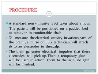 8-EEG.pptx