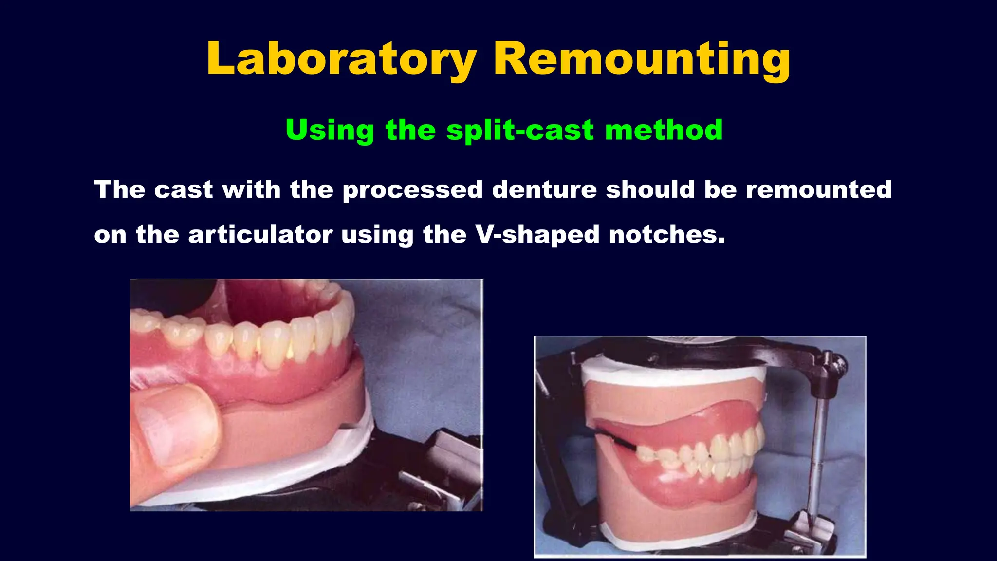 8- Complete denture insertion (Delivery).pptx