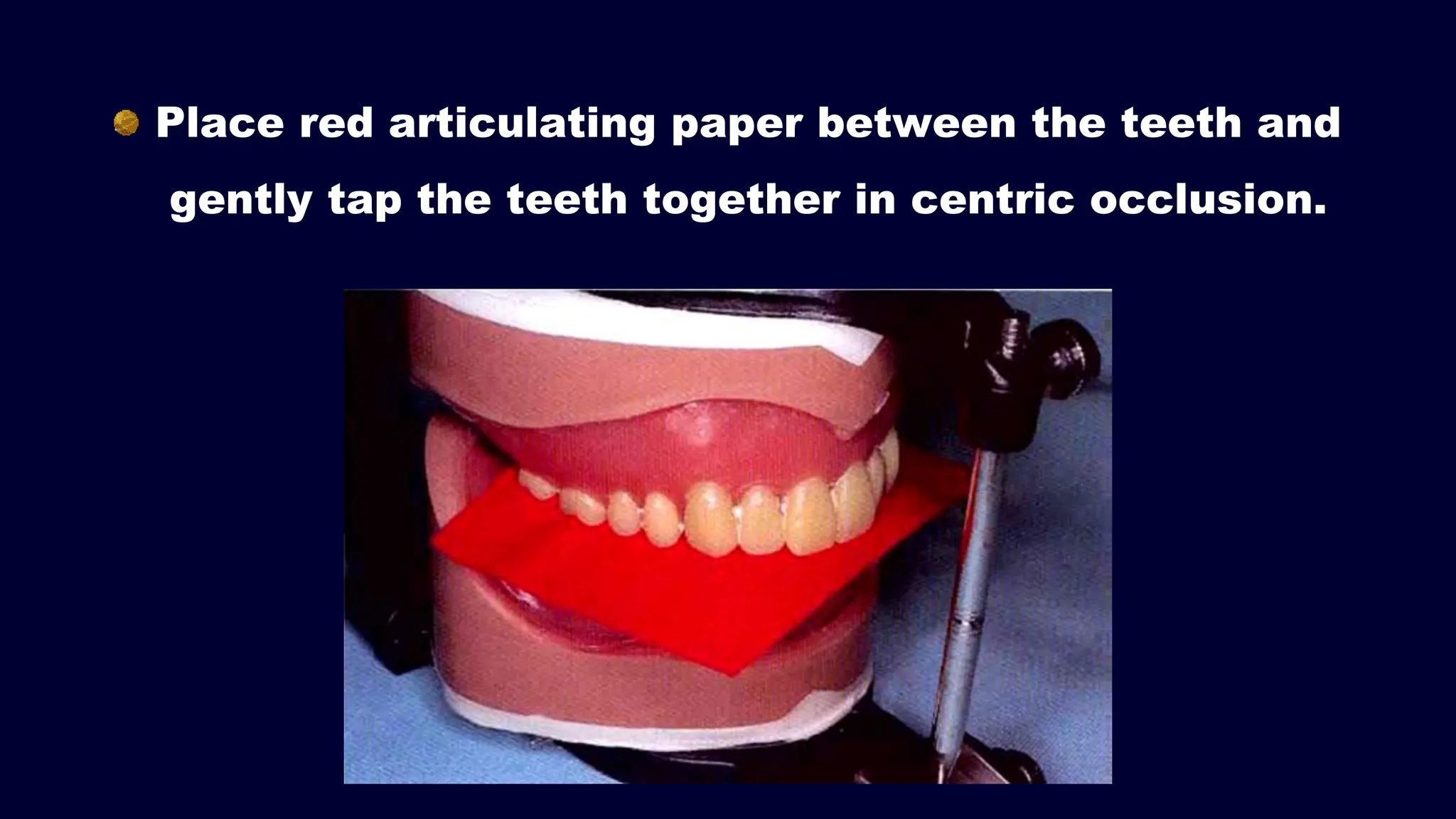 8- Complete denture insertion (Delivery).pptx