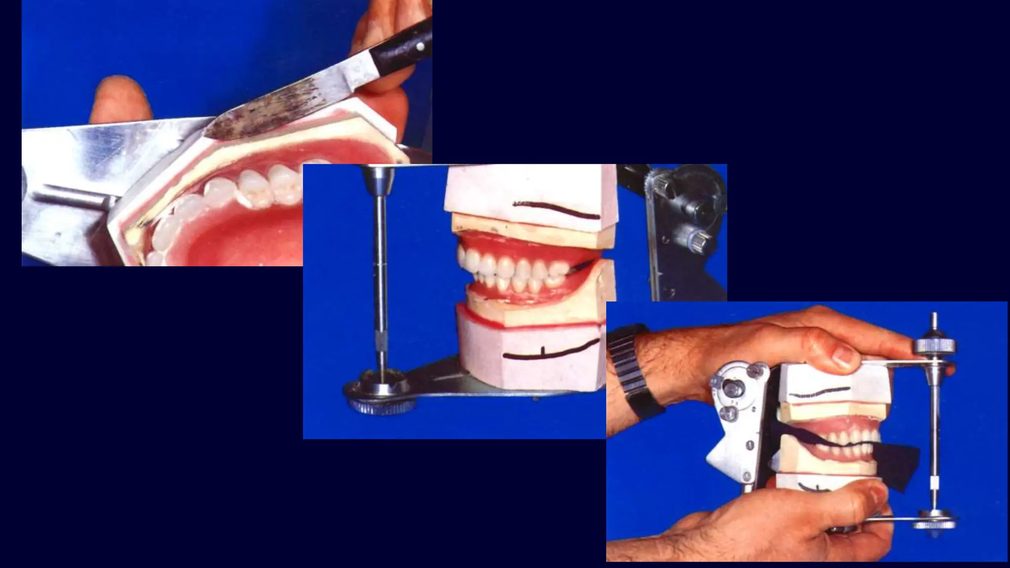 8- Complete denture insertion (Delivery).pptx