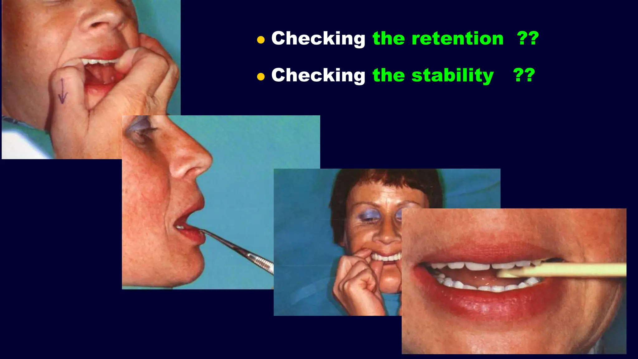 8- Complete denture insertion (Delivery).pptx