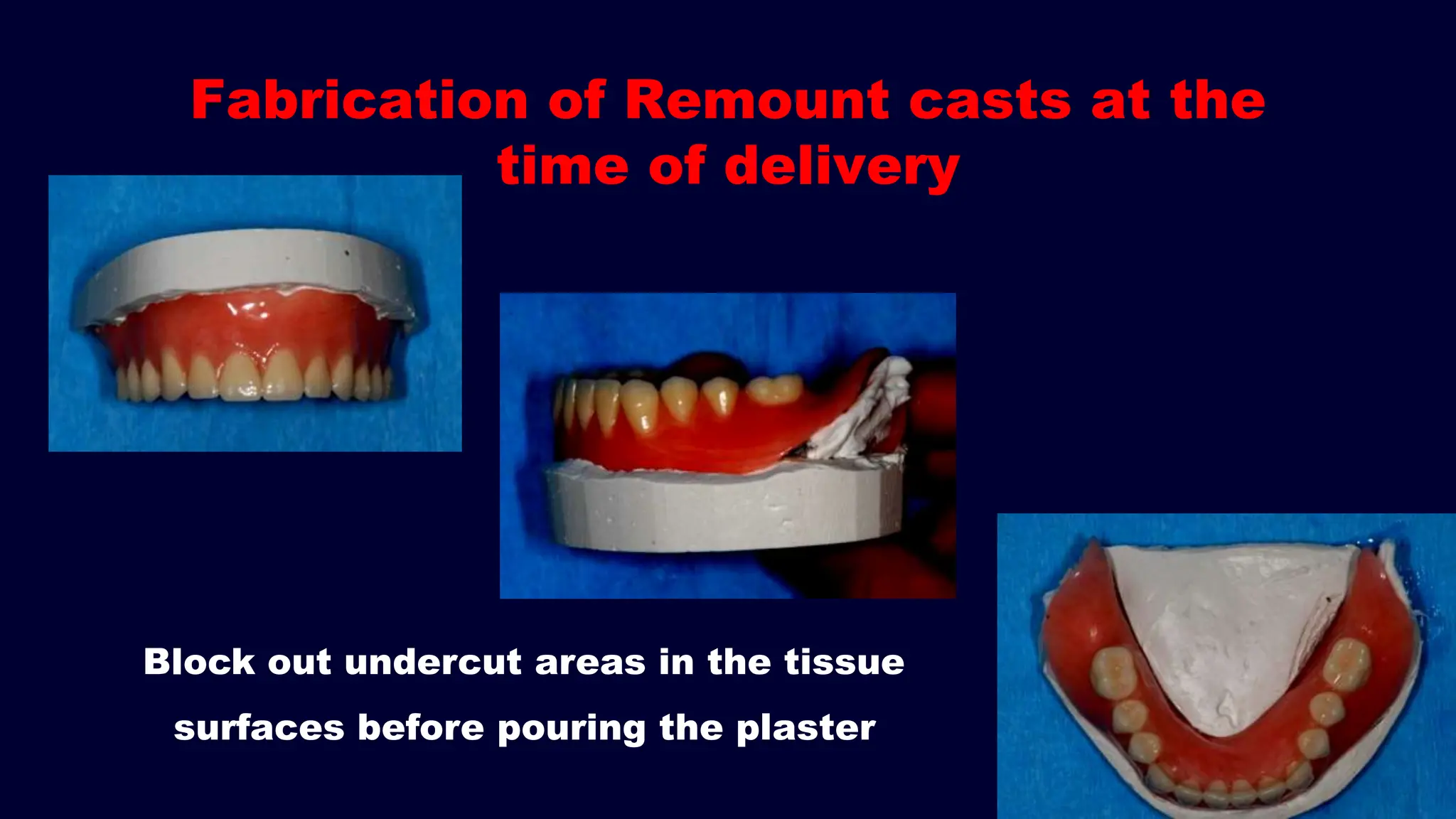 8- Complete denture insertion (Delivery).pptx