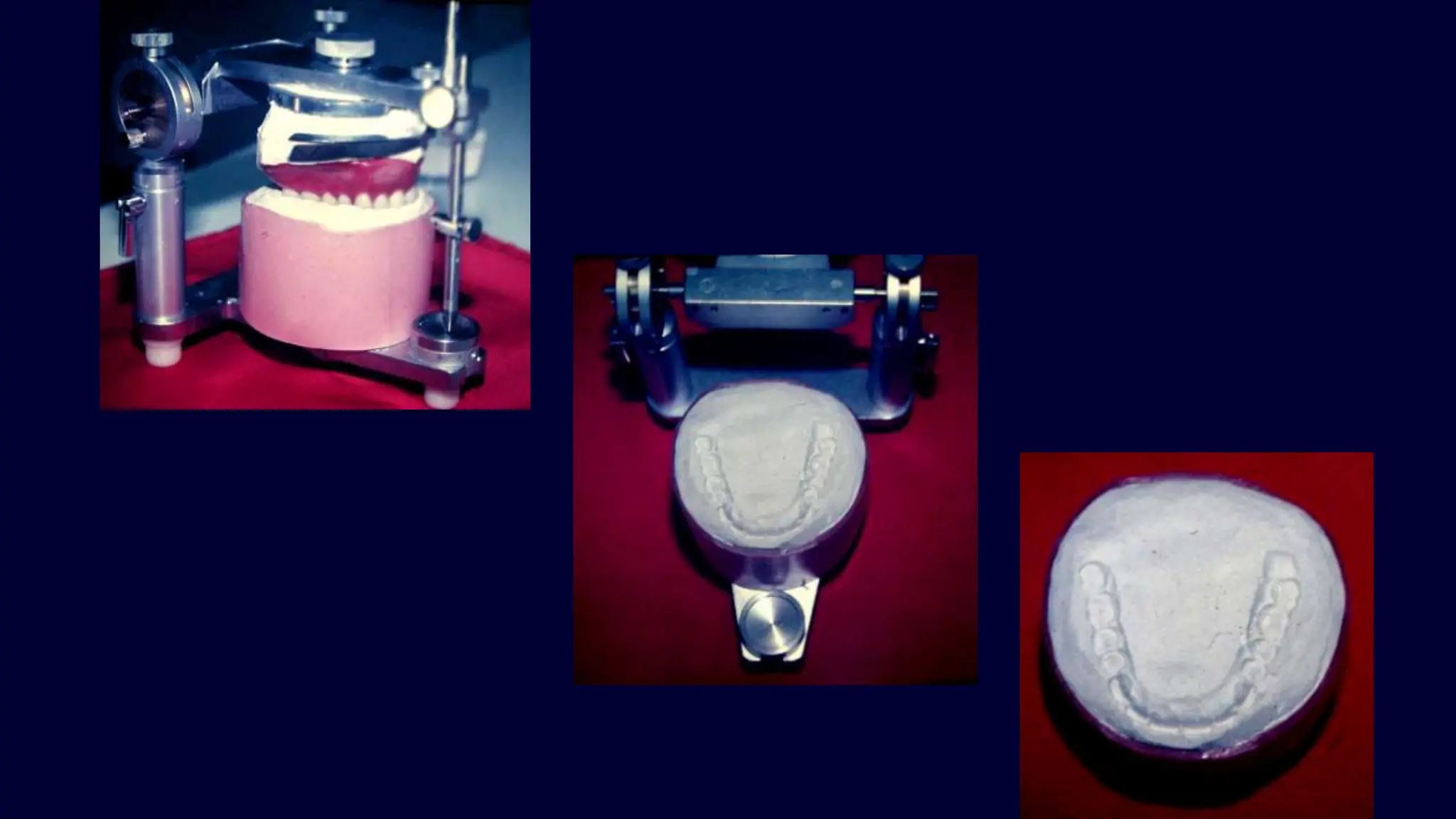 8- Complete denture insertion (Delivery).pptx