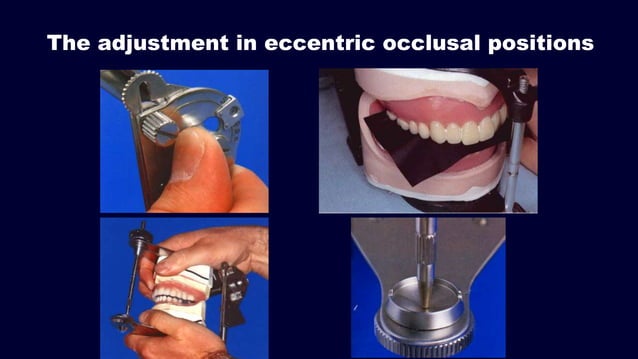 8- Complete denture insertion (Delivery).pptx