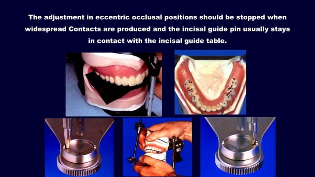 8- Complete denture insertion (Delivery).pptx