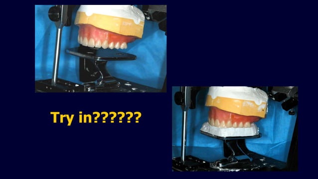 8- Complete denture insertion (Delivery).pptx