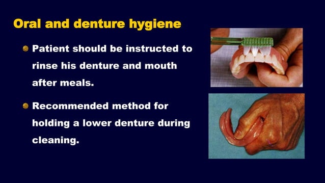 8- Complete denture insertion (Delivery).pptx