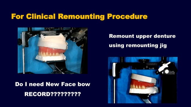 8- Complete denture insertion (Delivery).pptx