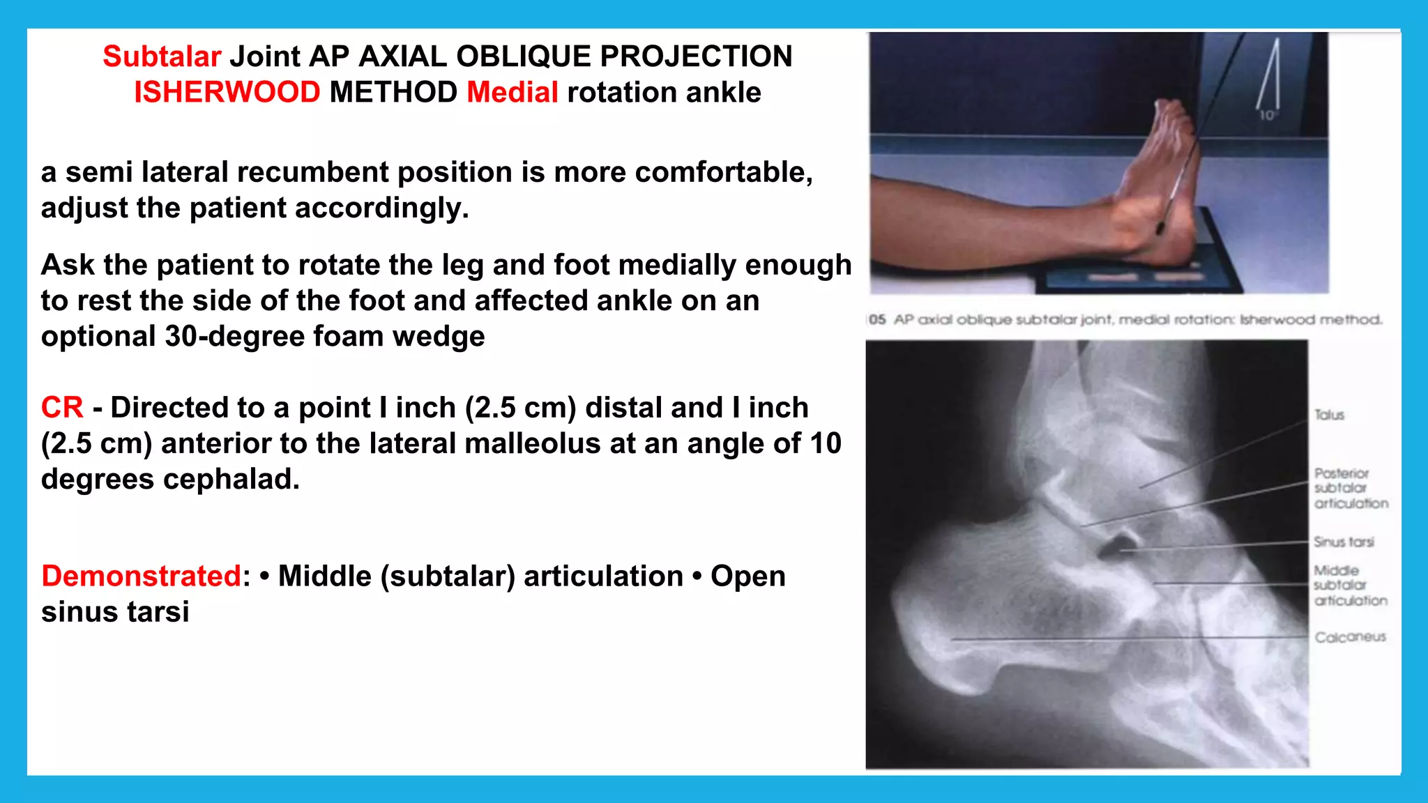 (8-F) 301 – A Tibia.pptx