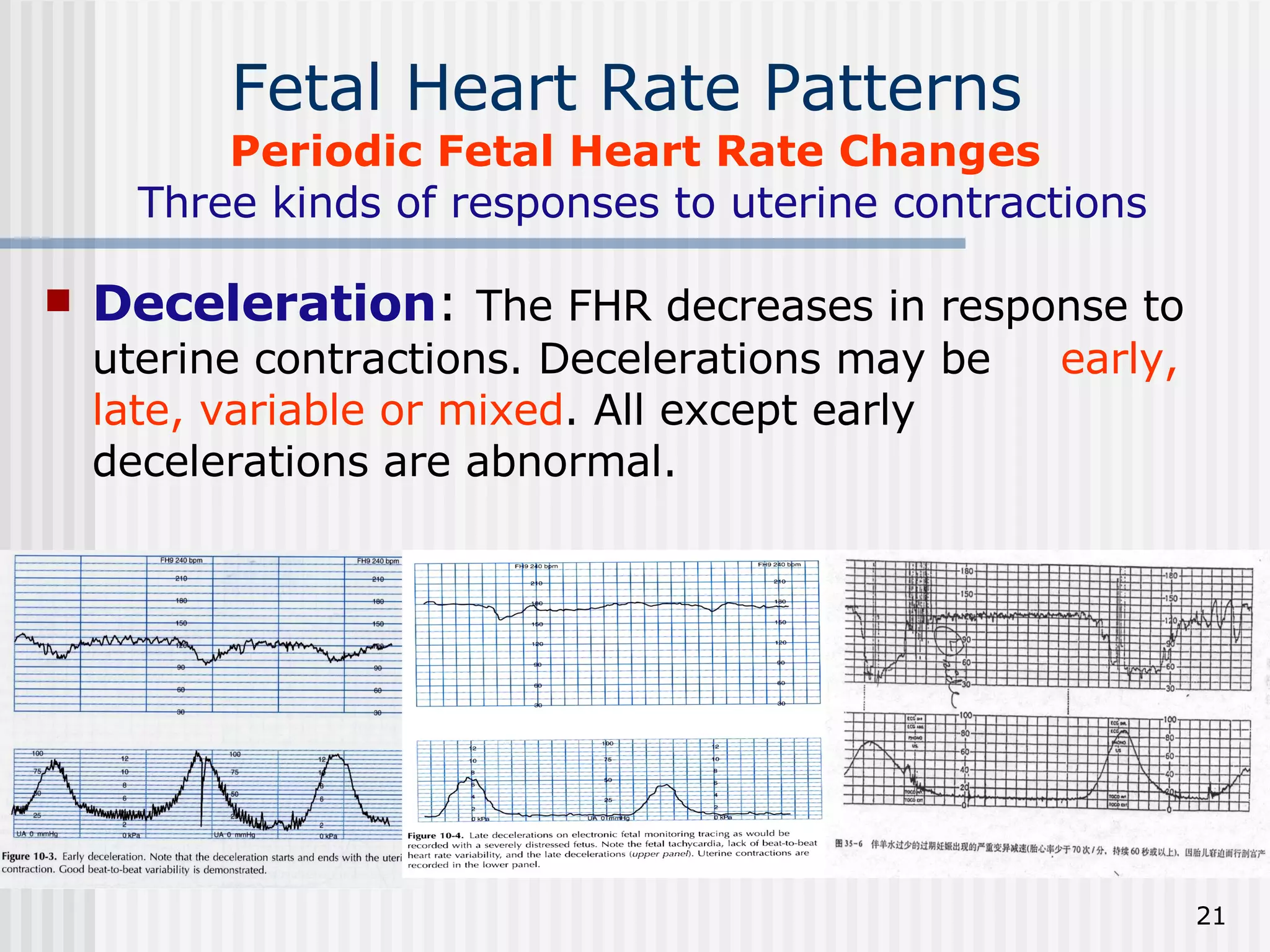 8.Fetal Surveillance During Labor | PPT
