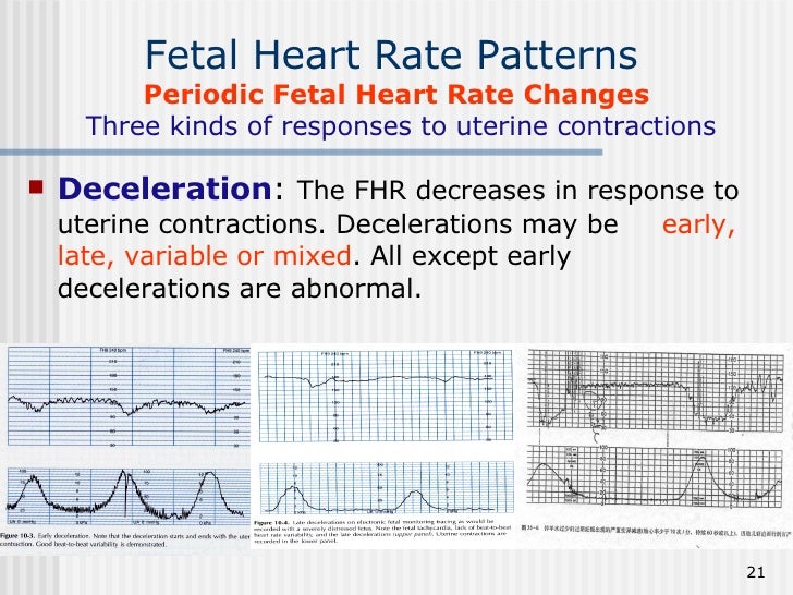 8.Fetal Surveillance During Labor
