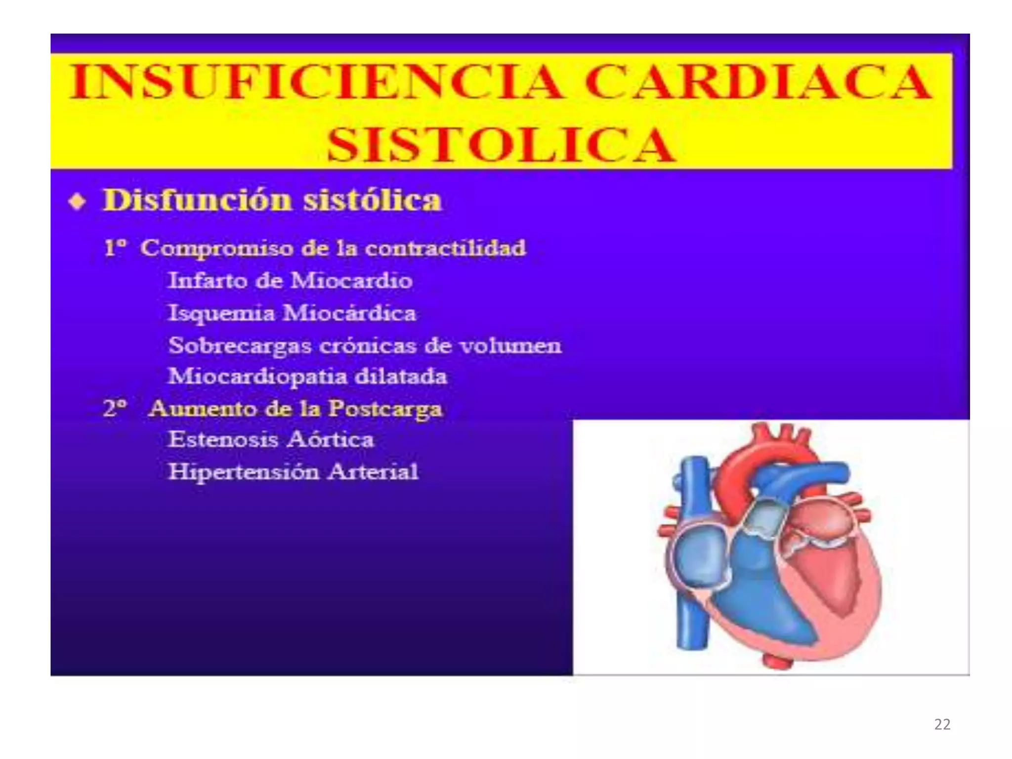 fisiopatológica de la insuficiencia cardiaca | PPT
