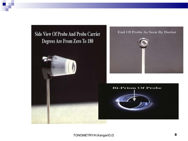 Goldman applanation tonometry | PPT