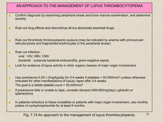 8-Guideline for elaborate SLE management.ppt