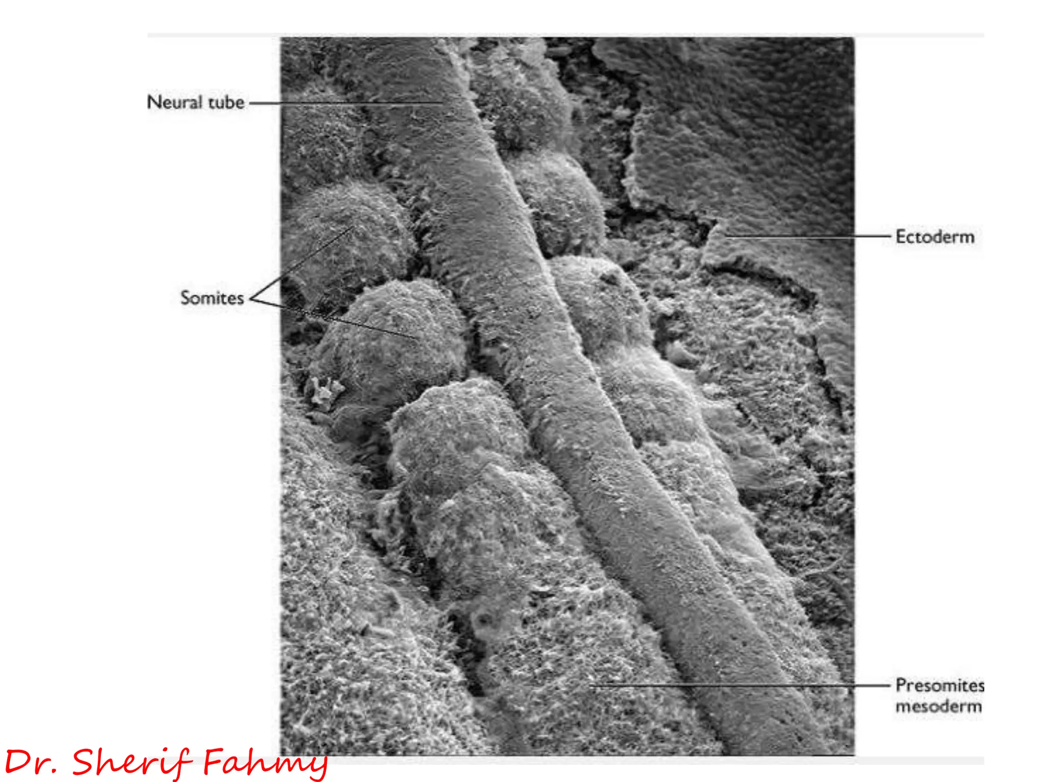 Intra-Embryonic Mesoderm (General Embryology) | PPSX