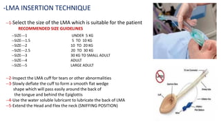 airway management -Anesthesia | PDF