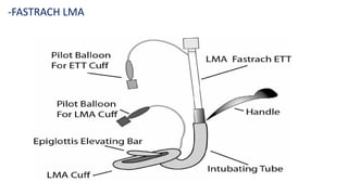 airway management -Anesthesia | PDF