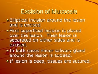 8 minor surgical procedures | PPT