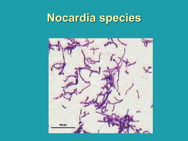 Gram positive bacilli morphology and classification | PDF