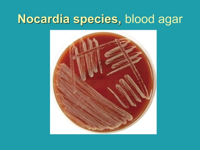 Gram positive bacilli morphology and classification | PDF
