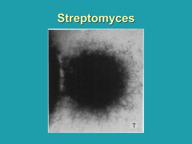 Gram positive bacilli morphology and classification | PDF