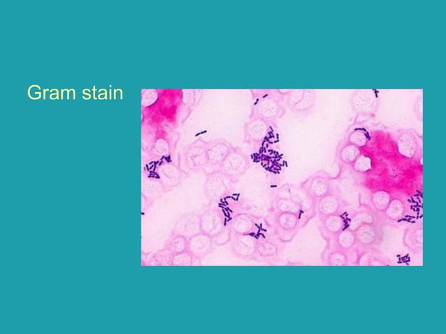 Gram positive bacilli morphology and classification | PDF