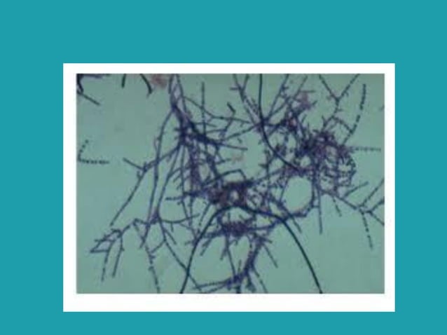 Gram positive bacilli morphology and classification | PDF