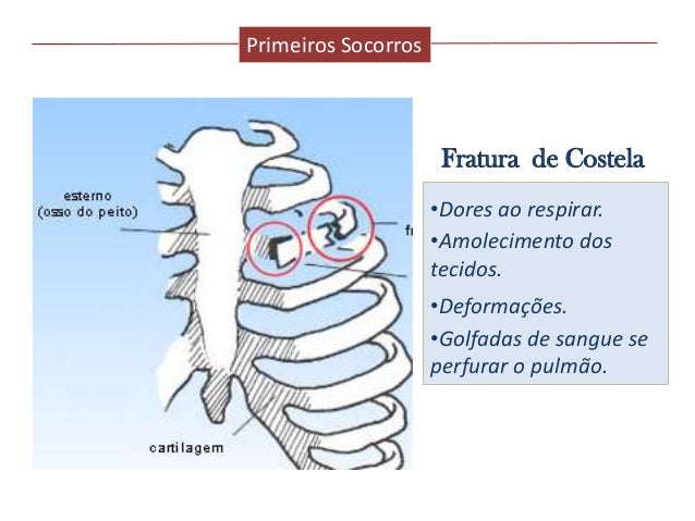 8. primeiros socorros