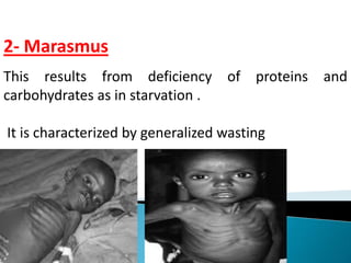 8-protein metabolism.pptx