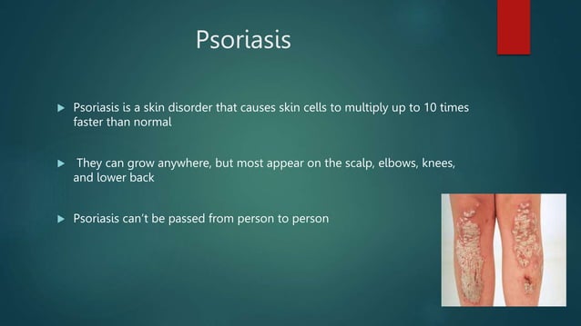 8- Psoriasis.pptx