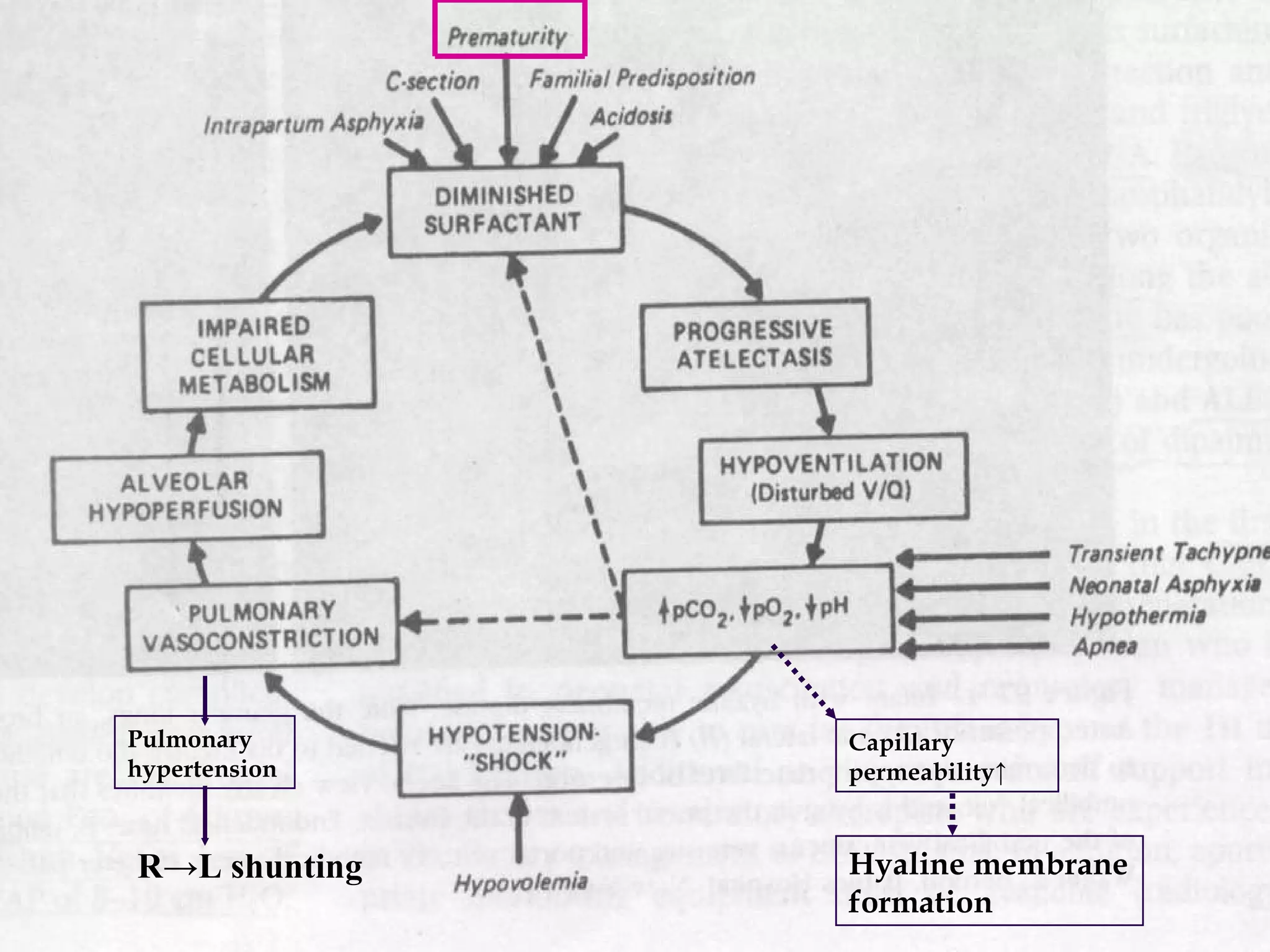 Respiratory Distress Syndrome (Rds) | PPT