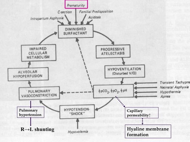 Respiratory Distress Syndrome (Rds) | PPT