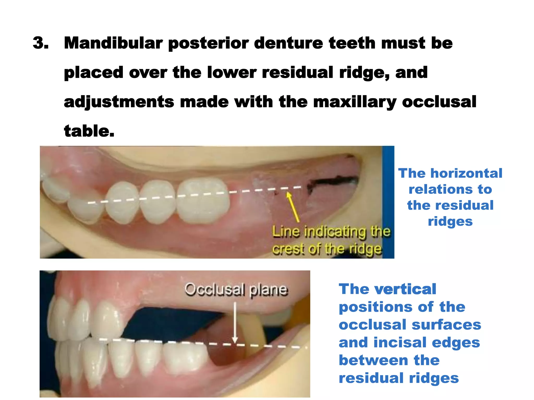8 - setting of teeth for class I, II and II arch relation ship (Edited ...