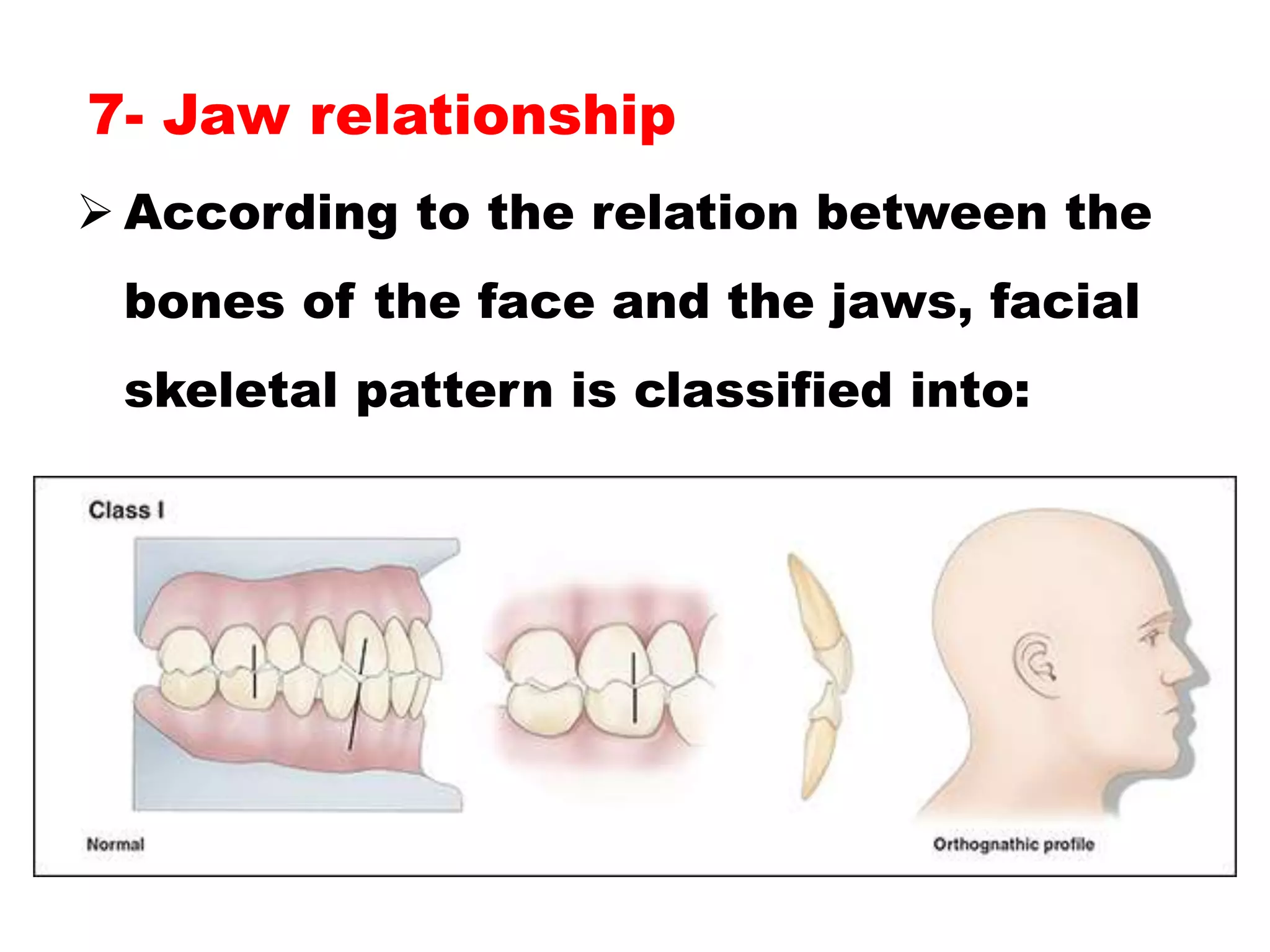 8 - setting of teeth for class I, II and II arch relation ship (Edited ...