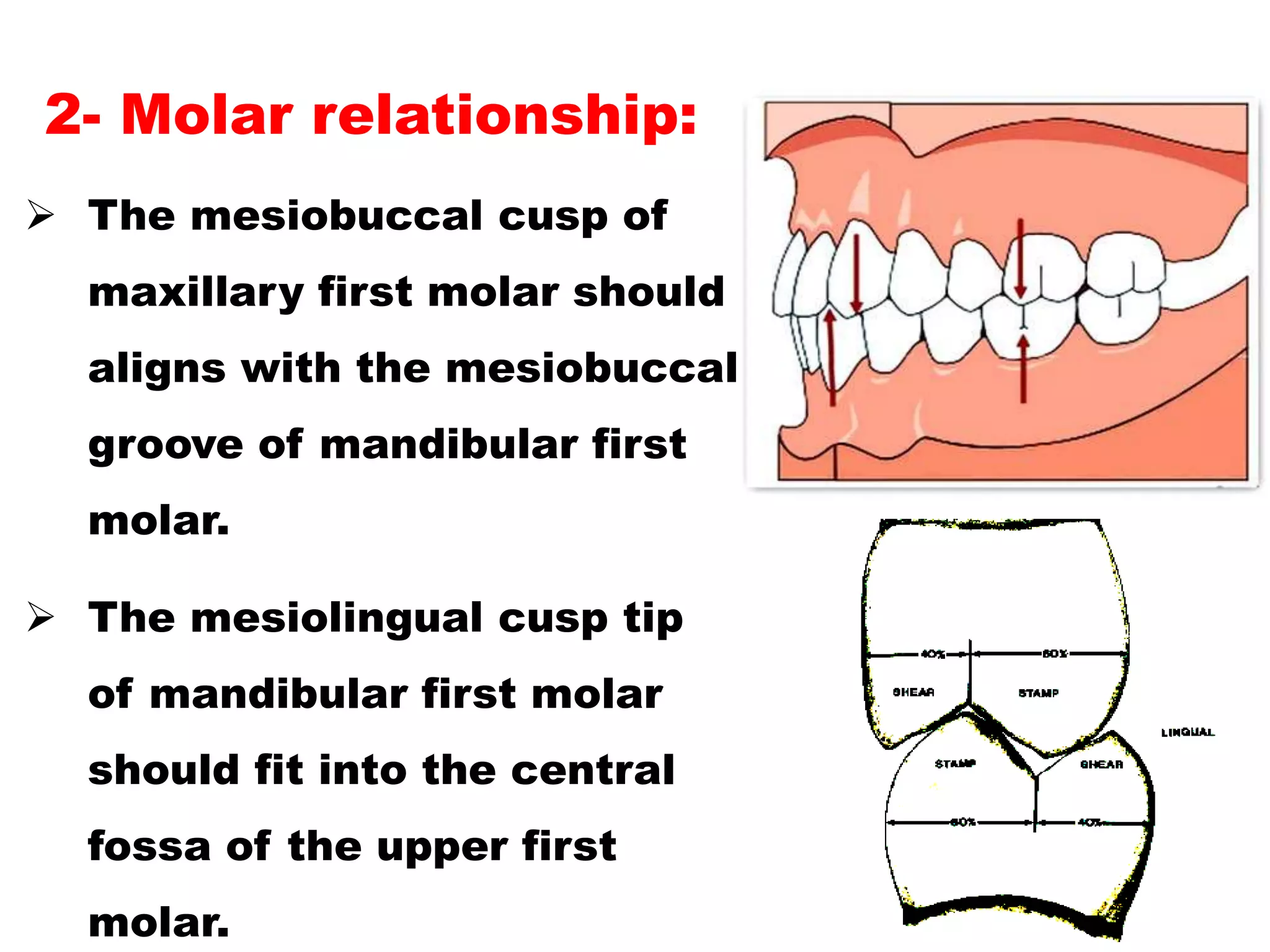 8 - setting of teeth for class I, II and II arch relation ship (Edited ...