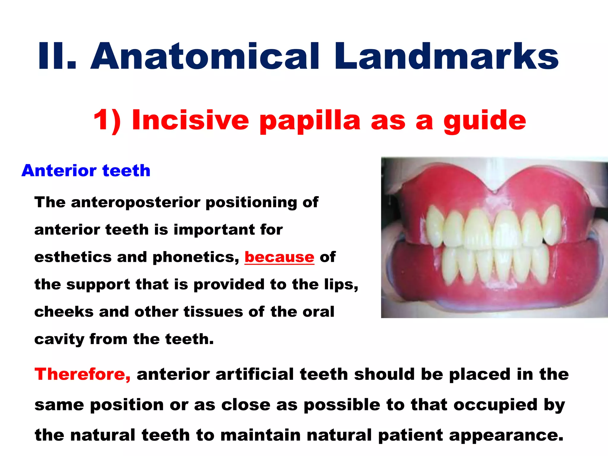8 - setting of teeth for class I, II and II arch relation ship (Edited ...