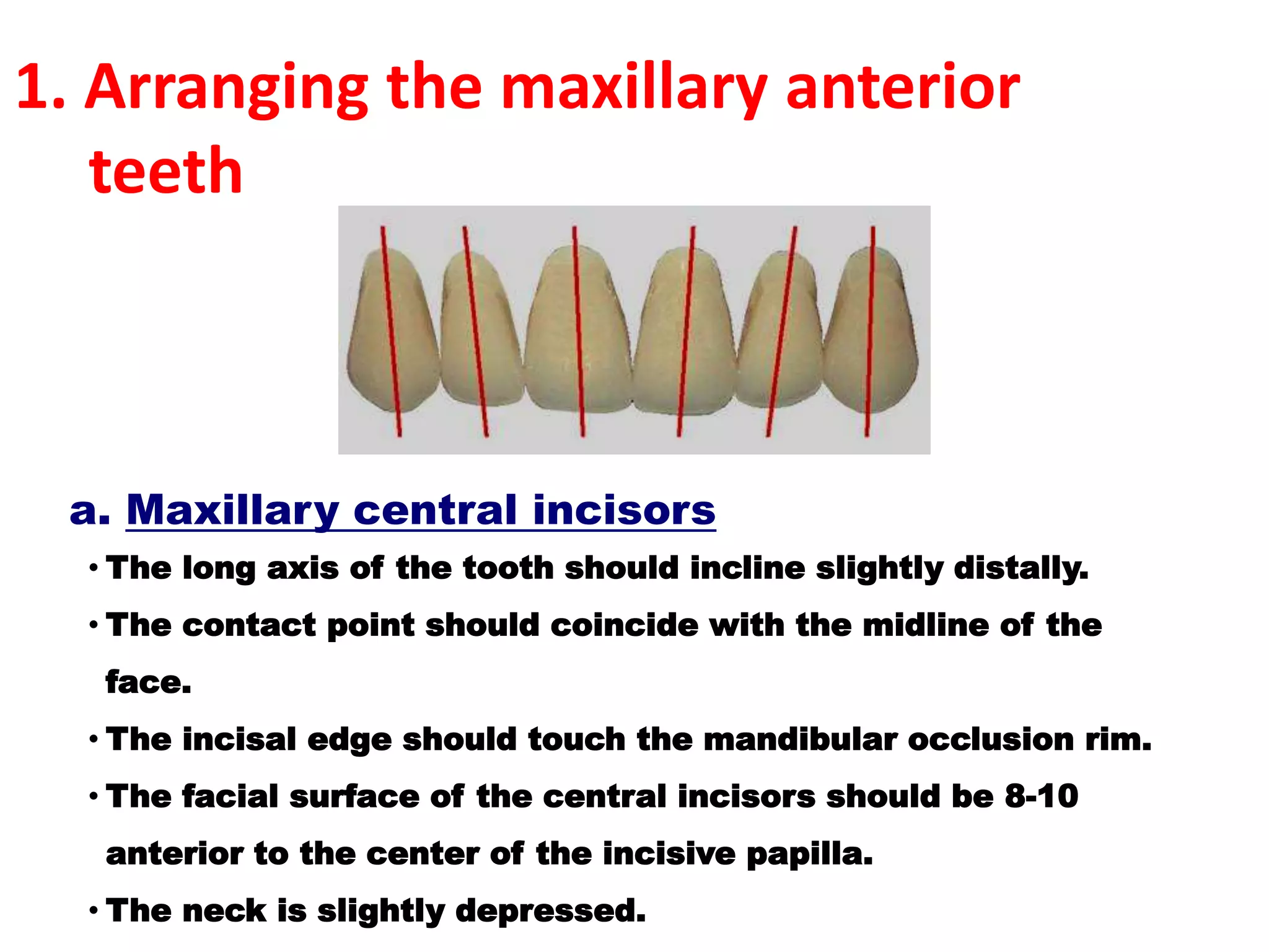 8 - setting of teeth for class I, II and II arch relation ship (Edited ...
