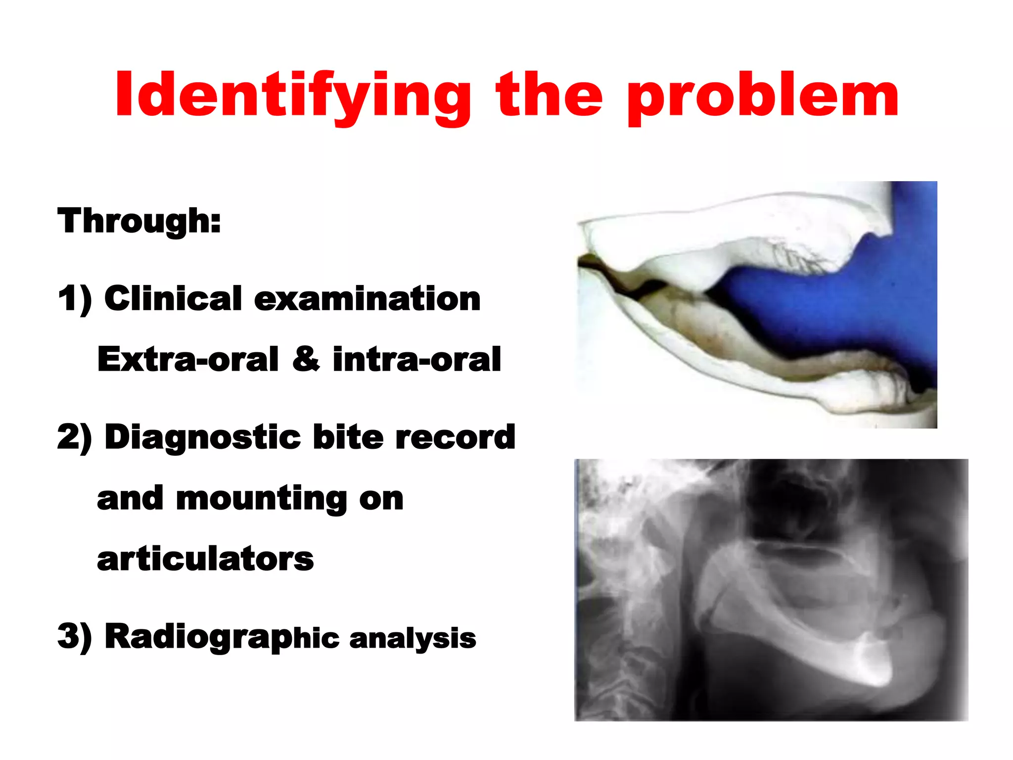 8 - setting of teeth for class I, II and II arch relation ship (Edited ...