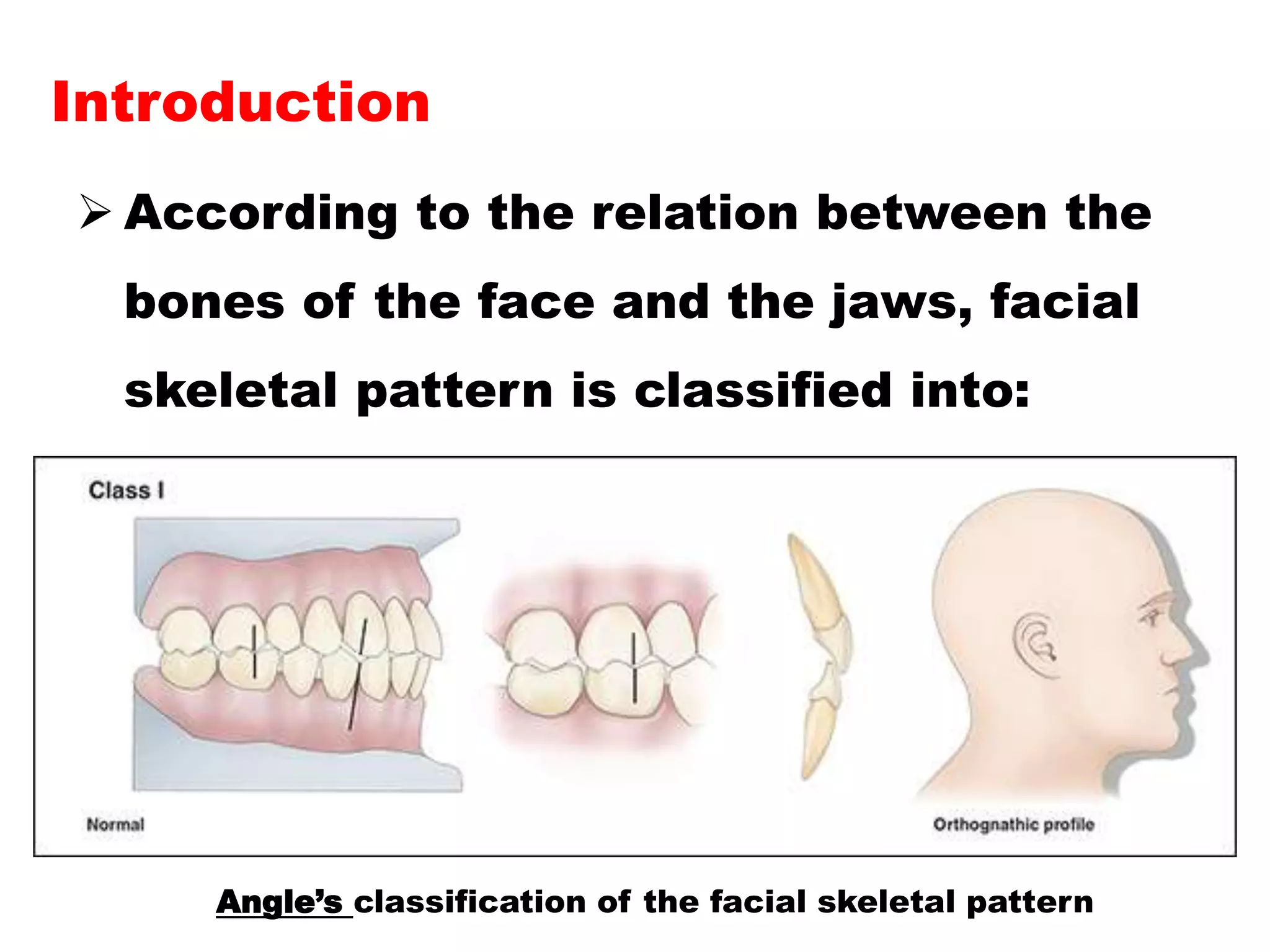 8 - setting of teeth for class I, II and II arch relation ship (Edited ...
