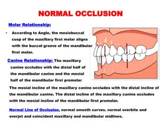 8 - setting of teeth for class I, II and II arch relation ship (Edited ...
