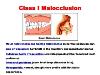 8 - setting of teeth for class I, II and II arch relation ship (Edited ...