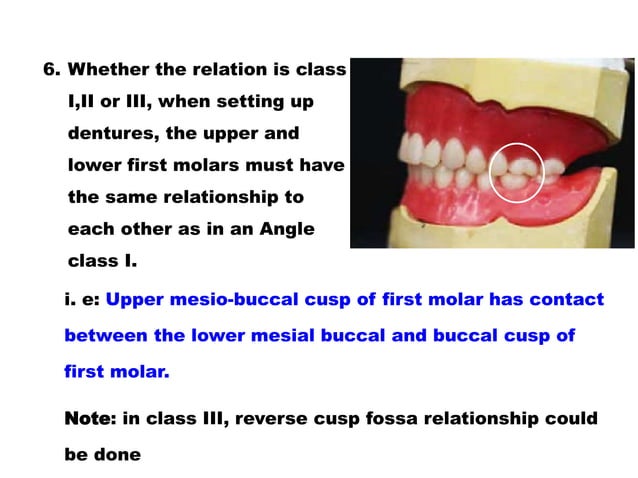 8 - setting of teeth for class I, II and II arch relation ship (Edited ...