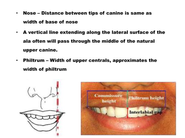 8 - setting of teeth for class I, II and II arch relation ship (Edited ...