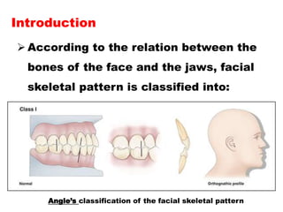 8 - setting of teeth for class I, II and II arch relation ship (Edited ...