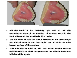 8 - setting of teeth for class I, II and II arch relation ship (Edited ...