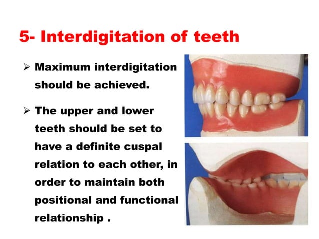 8 - setting of teeth for class I, II and II arch relation ship (Edited)
